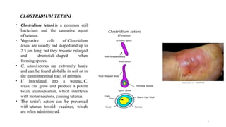 WHAT IS A TETANUS ?HOW IT OCCURS AND PREVENTIVE MEASURES.pptx