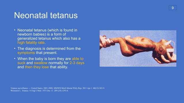 presentasi tentang judul yang Tetanus .pptx