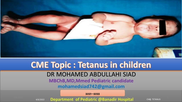 Tetanus in children Dr. ozil | PPTX