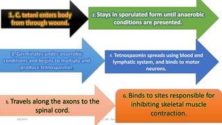 Tetanus in children Dr. ozil | PPTX