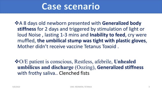 Tetanus in children Dr. ozil | PPTX