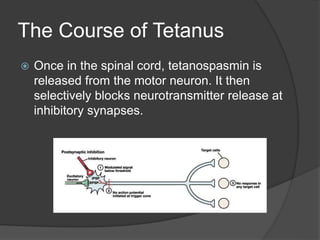 MATERI MANAJEMEN OF PENYAKIT TETANUS.ppt | Brain and Nervous System ...