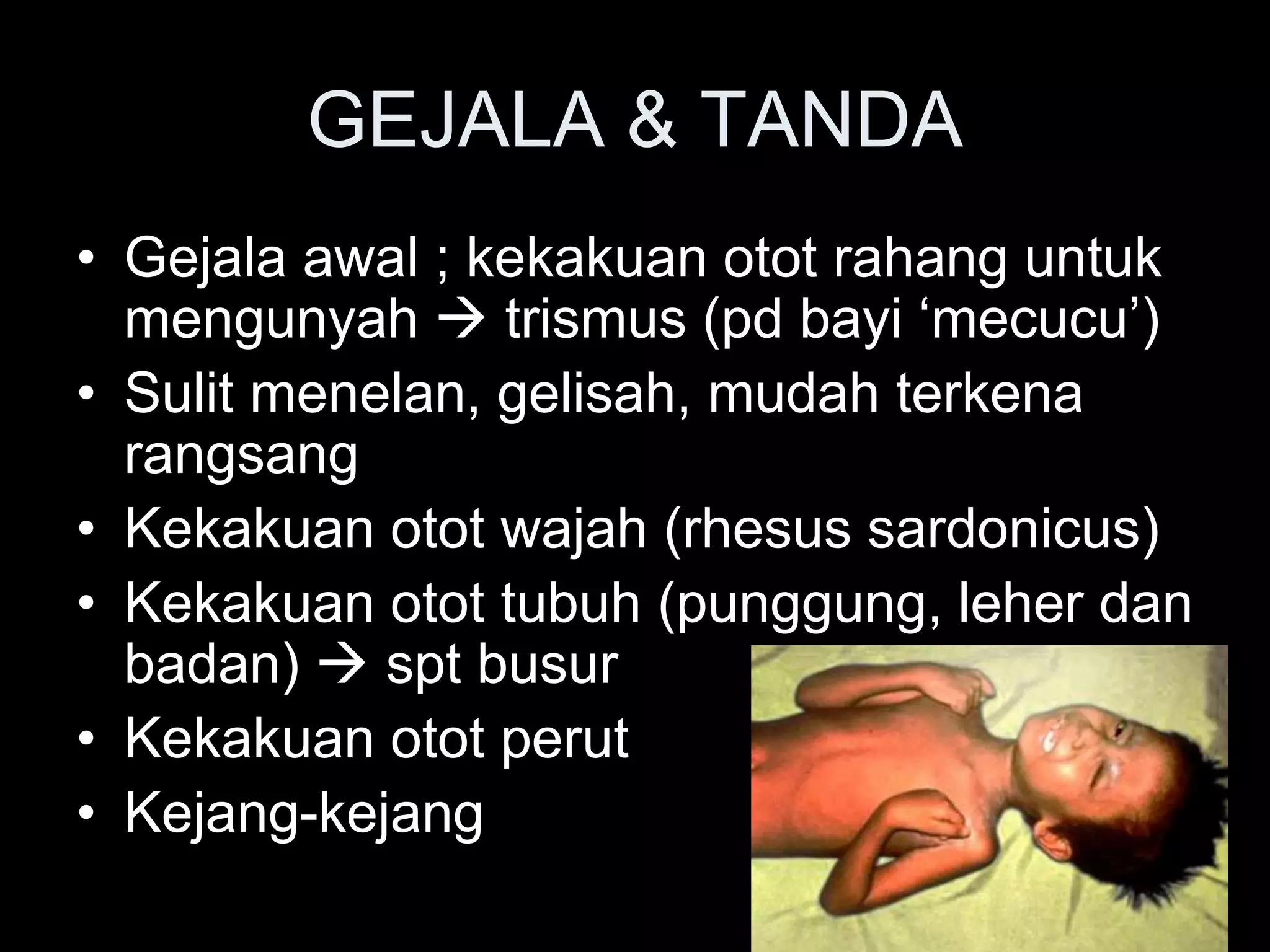 TEtanus Neonatirum.ppt
