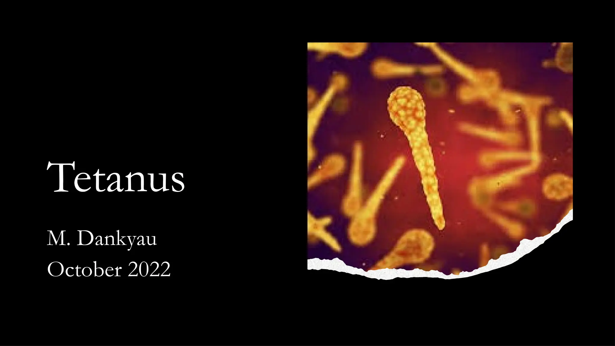 Definition and principles of Management of neonatal tetanus, | PPT