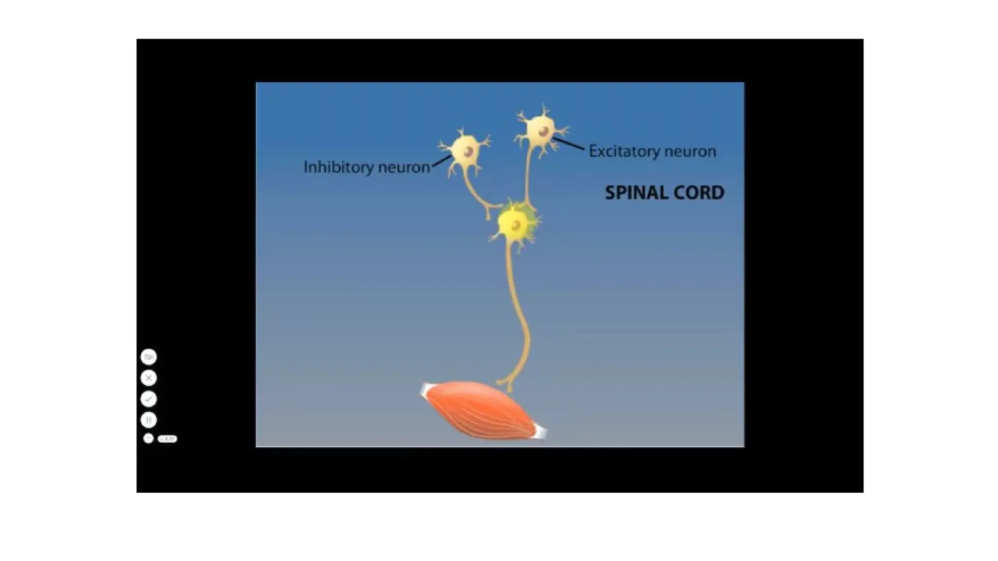 Definition and principles of Management of neonatal tetanus, | PPT