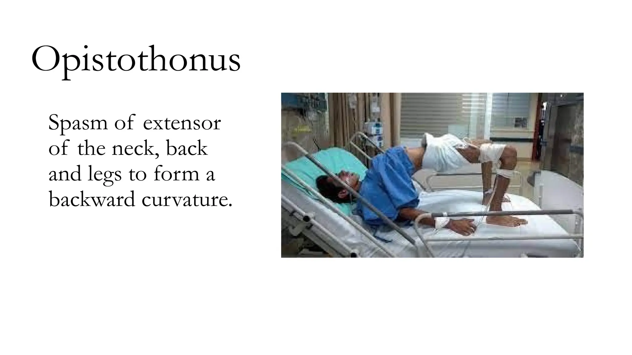 Definition and principles of Management of neonatal tetanus, | PPT