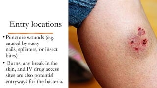 Definition and principles of Management of neonatal tetanus, | PPTX