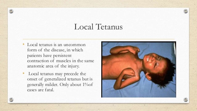 Tetanus
