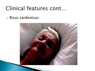 Tetanus prophylaxis and types of immunitynewnewv | PPTX