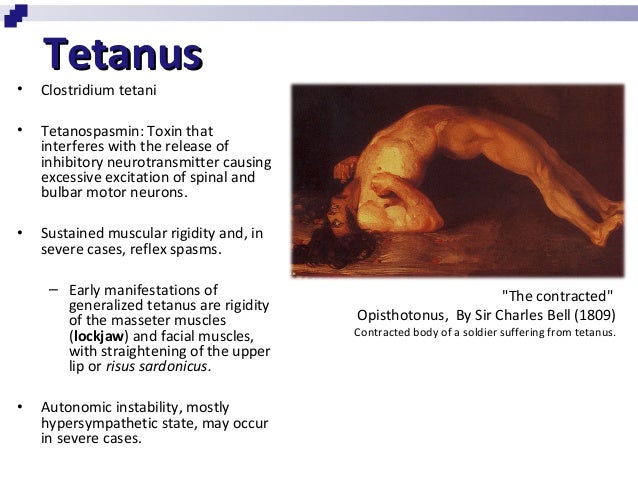 Tetanus-strichnine toxicity & rabies