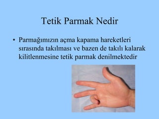 Tetik Parmak | PPT