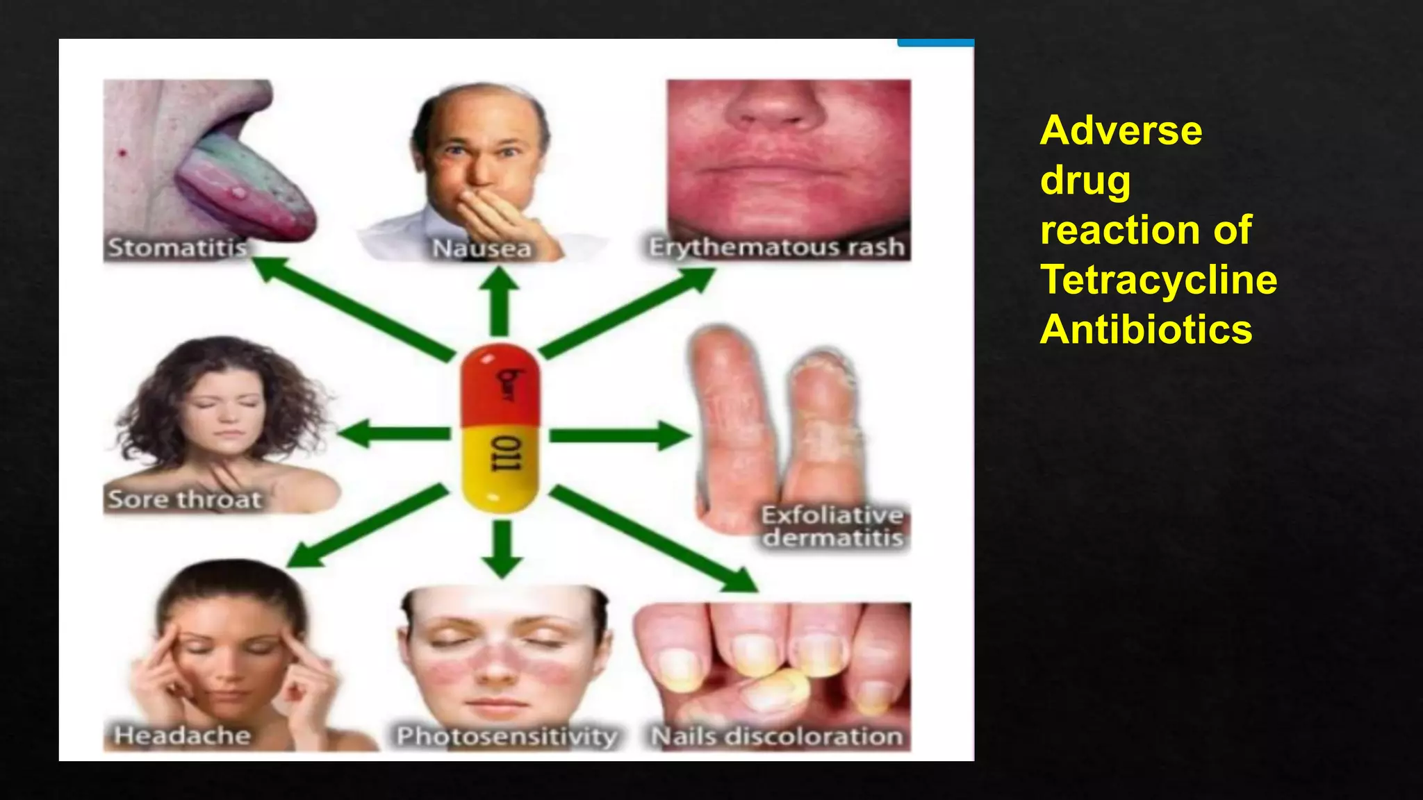 Tetracycline - Medical Microbiology | PPTX