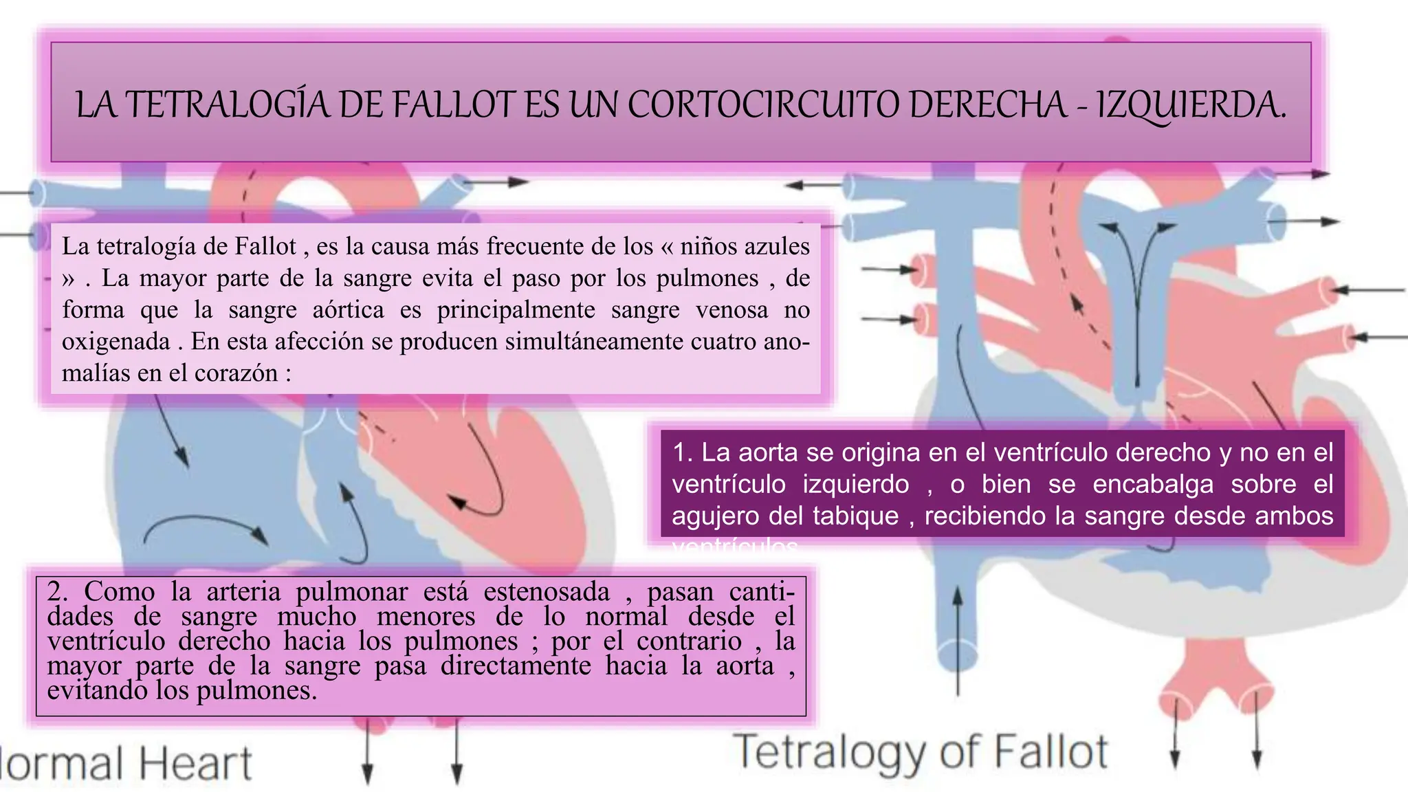 FISIOLOGIA DE LAS VALVULAS TETRALOGIA DE FALLOT.pptx