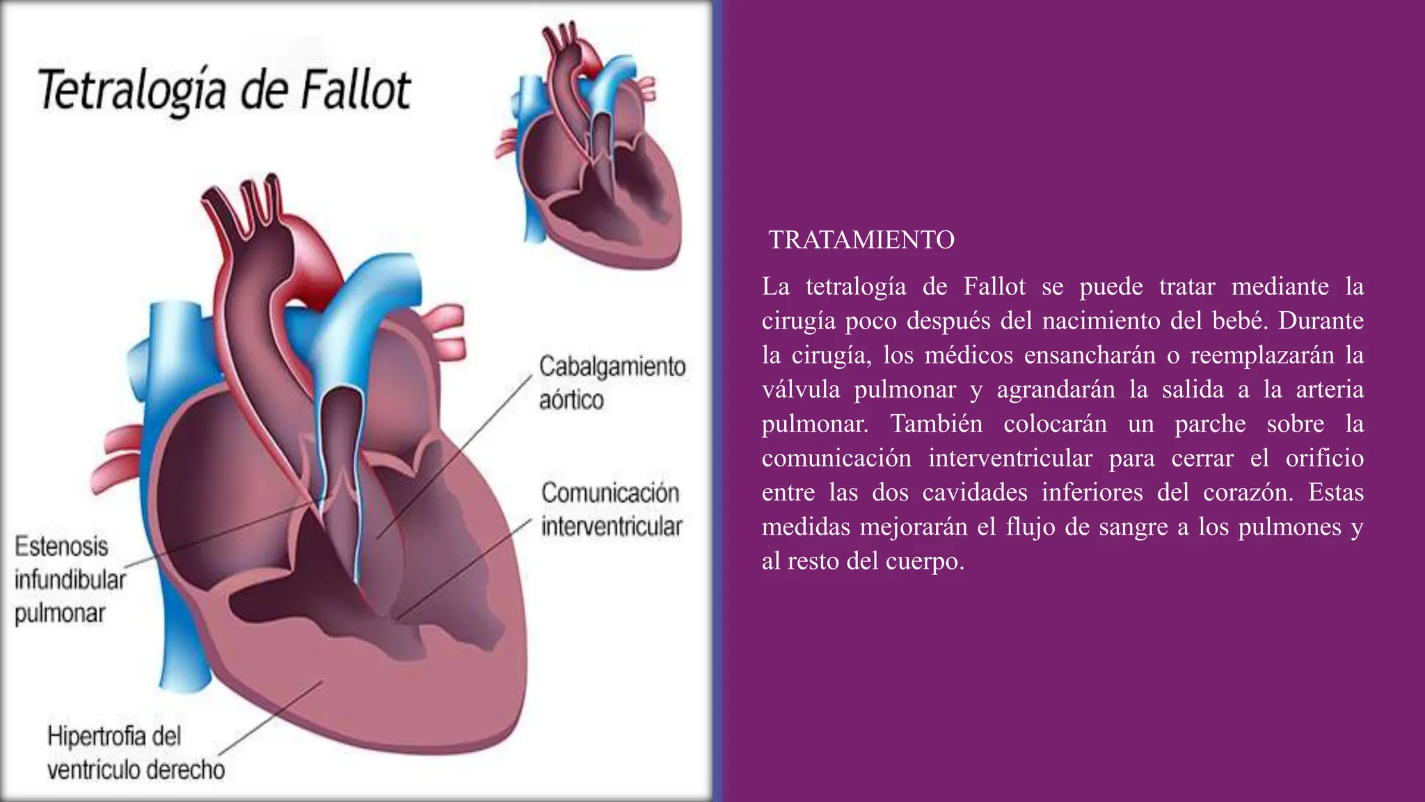 FISIOLOGIA DE LAS VALVULAS TETRALOGIA DE FALLOT.pptx