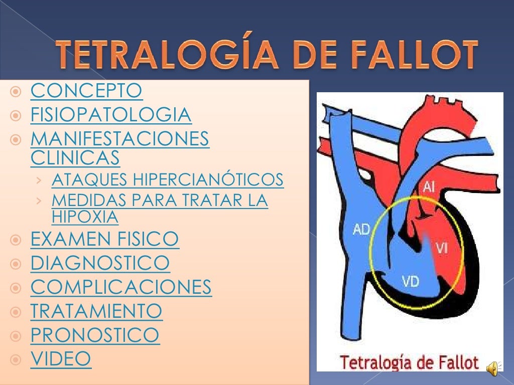 Tetralogia De Fallot Expectativa De Vida - RETOEDU