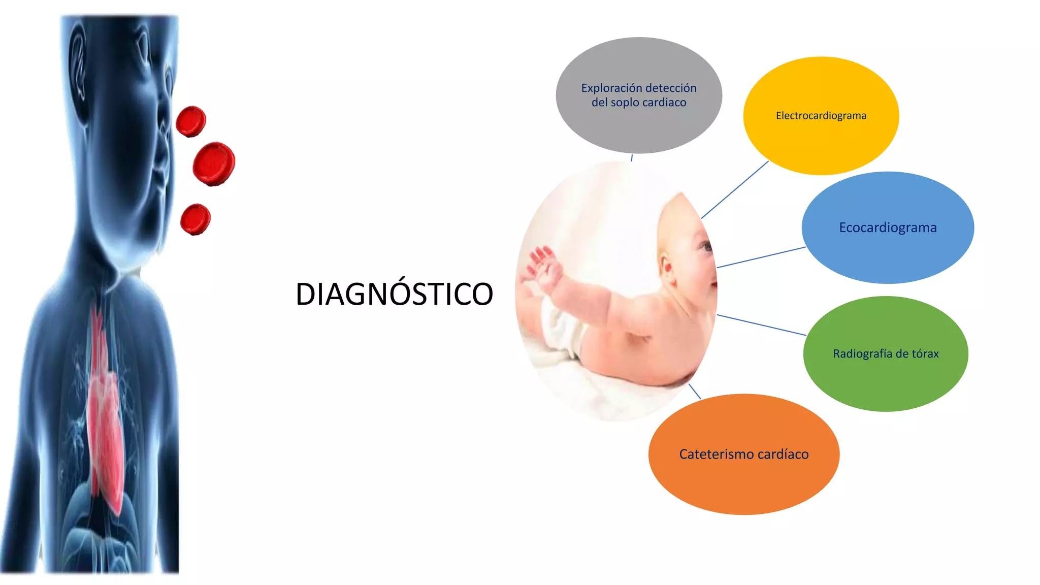Tetralogia de falot | PPT