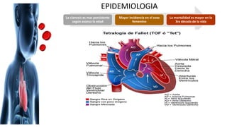 Tetralogia de falot | PPTX