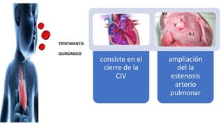 Tetralogia de falot | PPTX