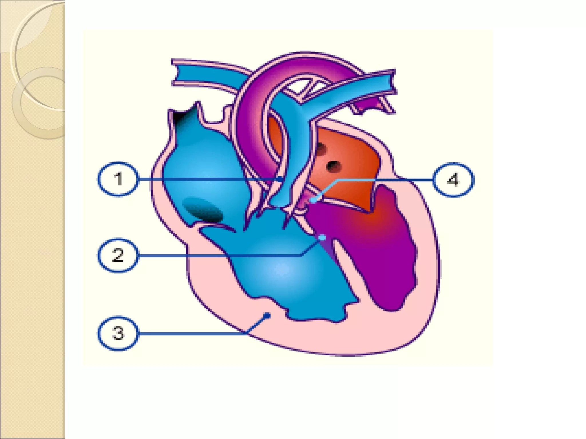 Tetralogy of fallot | PPT