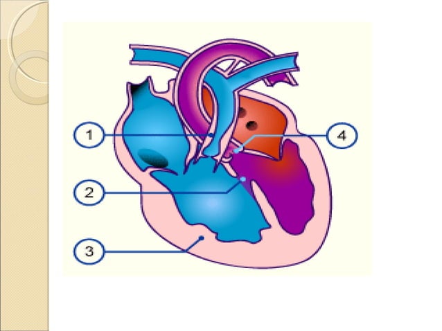 Tetralogy of fallot | PPT | Heart and Cardiovascular Diseases ...