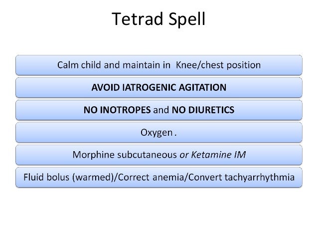 Tetralogy of fallot