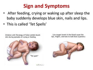 Knee Chest Position Child