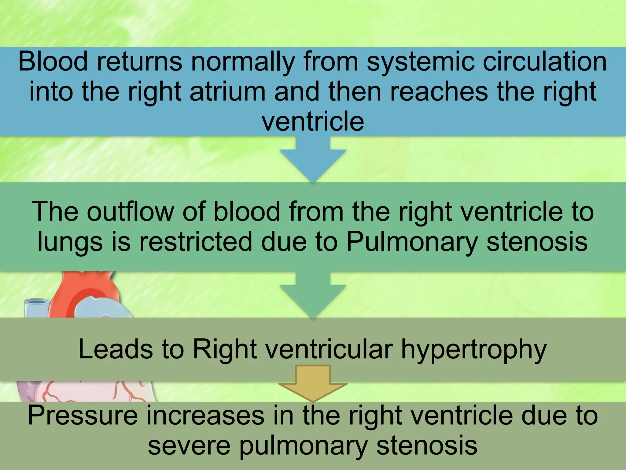 tetralogy of fallot/TOF .pptx