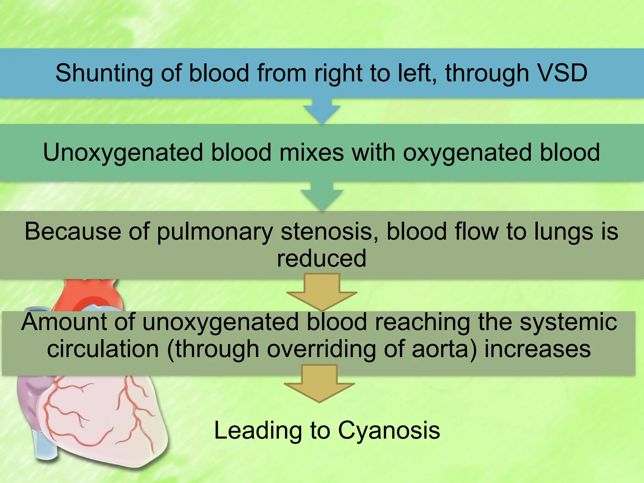 tetralogy of fallot/TOF .pptx