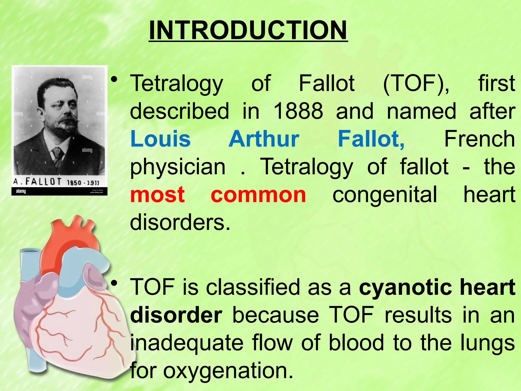 tetralogy of fallot/TOF .pptx