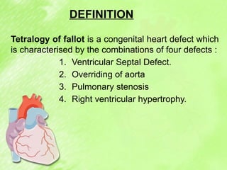 tetralogy of fallot/TOF .pptx