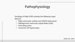 Tetralogy of Fallot, the history and treatment | PPTX