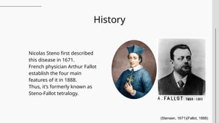 Tetralogy of Fallot, the history and treatment | PPTX