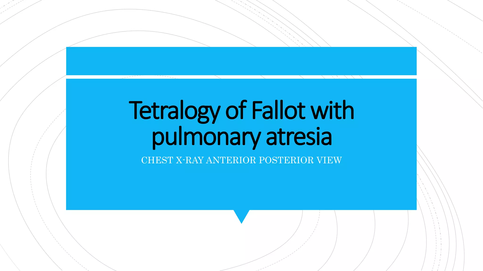 Tetralogy of fallot with pulmonary atresia | PPTX