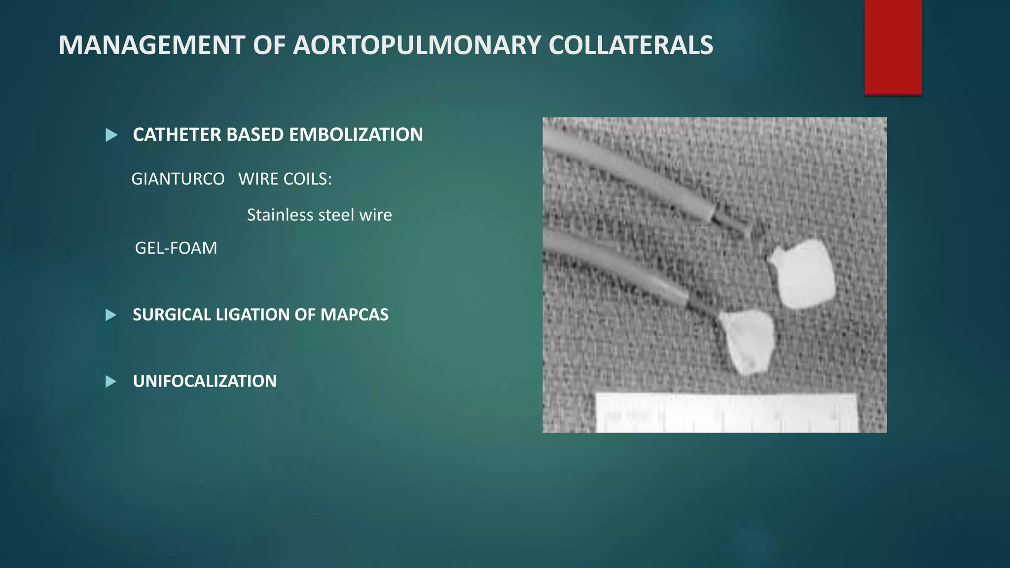 Tetrology of fallot corrective surgeries | PPTX