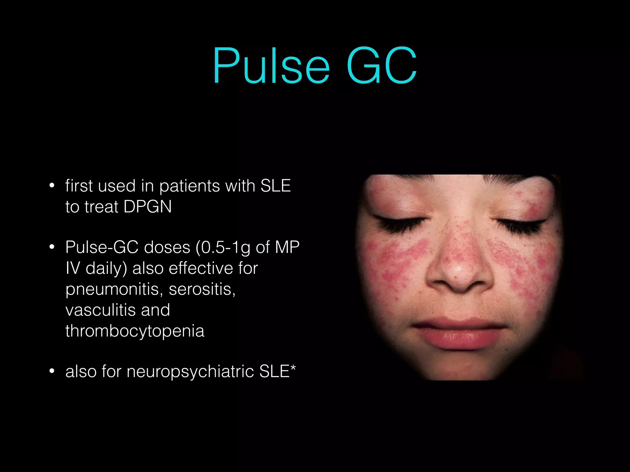 Methyprednisolone Pulse Therapy for Nurses | PDF