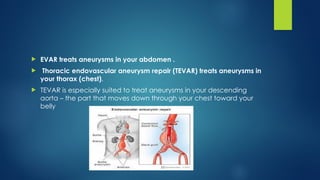 TEVARA thoracoabdominal aortic aneurysm is a bulging in the aorta that ...
