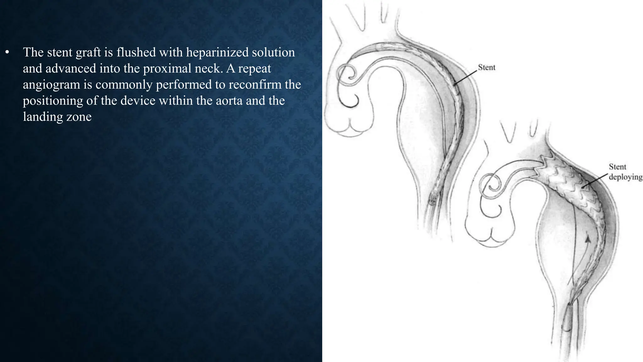 Tevar & evar ppt by Dr. Amrit kumar CTVS | PPTX