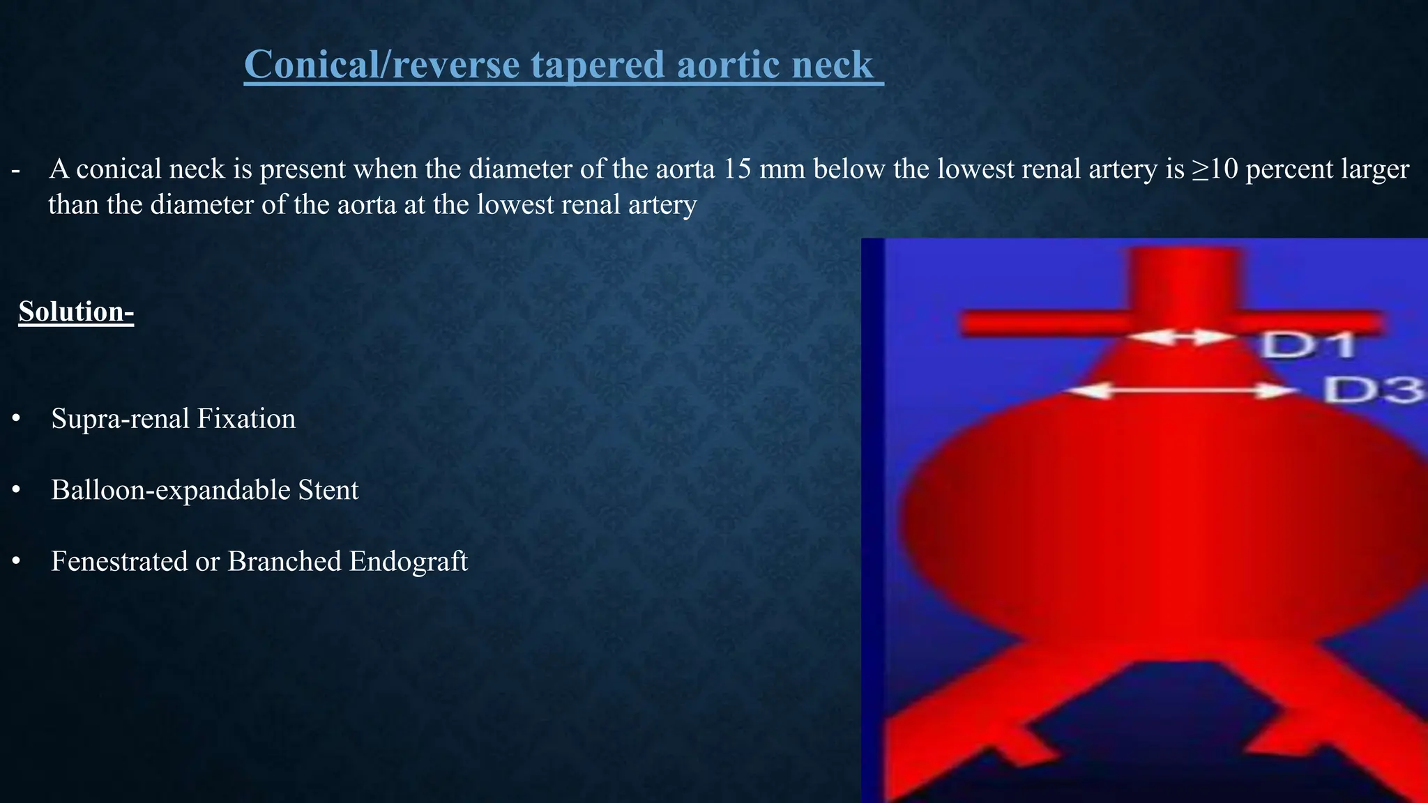 Tevar & evar ppt by Dr. Amrit kumar CTVS | PPTX