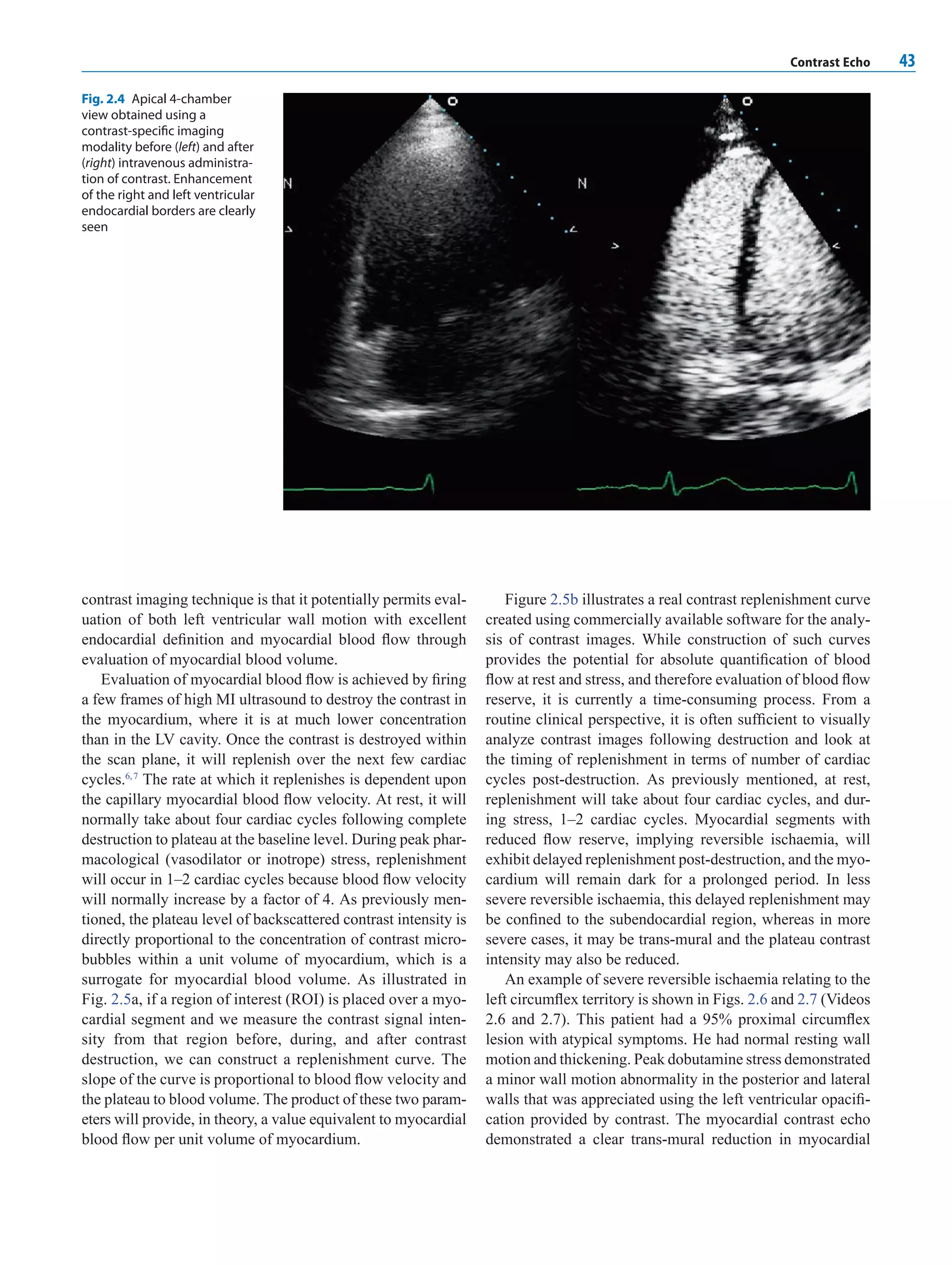 ESC Textbook on cardiovascular imaging | PDF