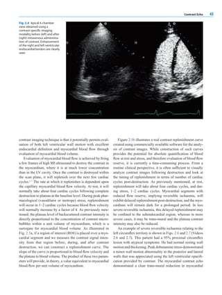 ESC Textbook on cardiovascular imaging | PDF