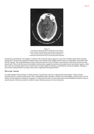 Textbook of neuroanaesthesia and critical care' | PDF