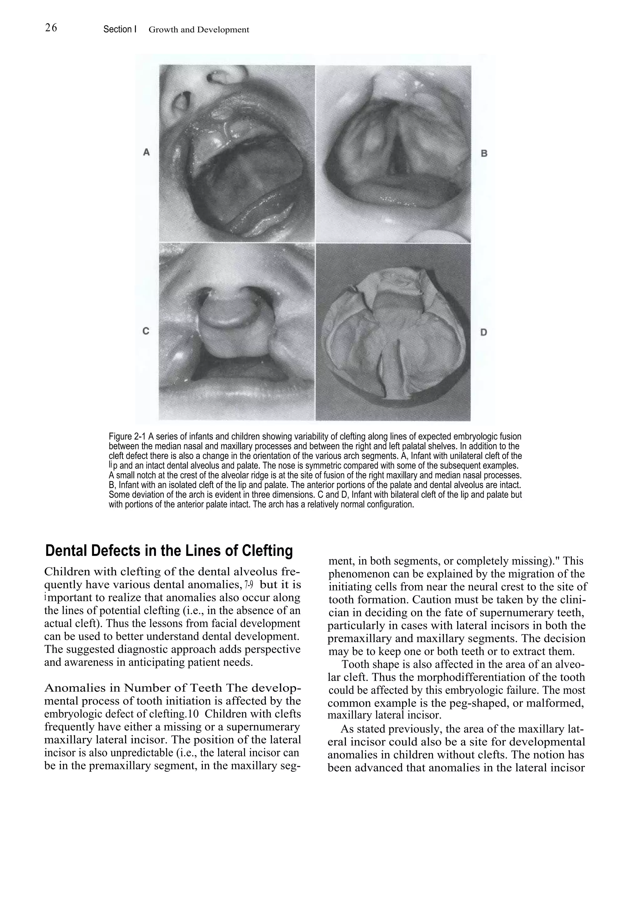 Text book of orthodontics | PDF