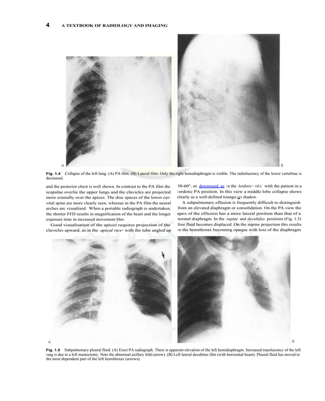 Textbook of Radiology and Imaging (Vol. 1) ( PDFDrive ).pdf