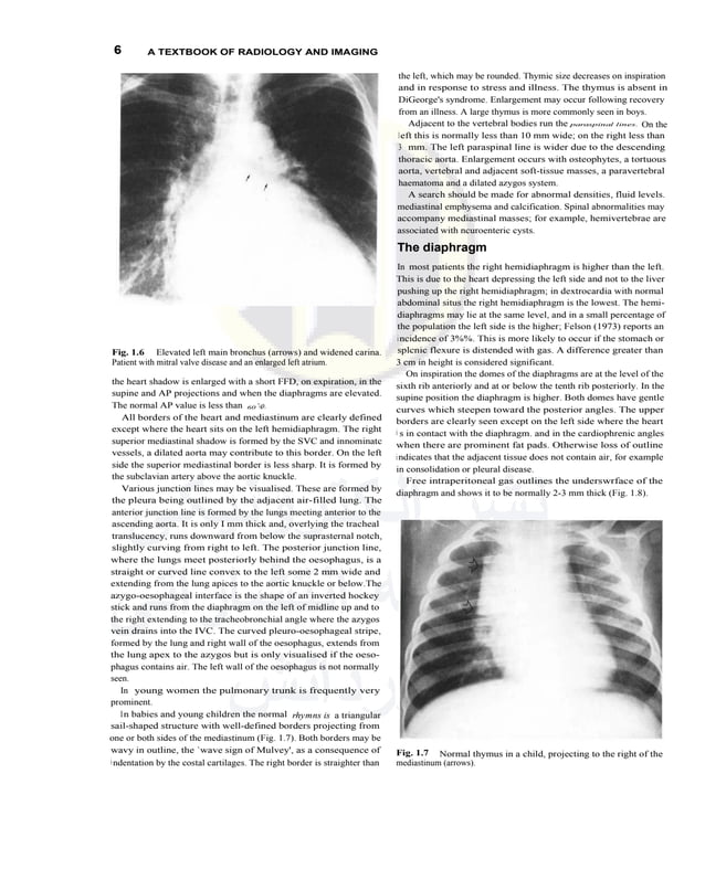 Textbook of Radiology and Imaging (Vol. 1) ( PDFDrive ).pdf