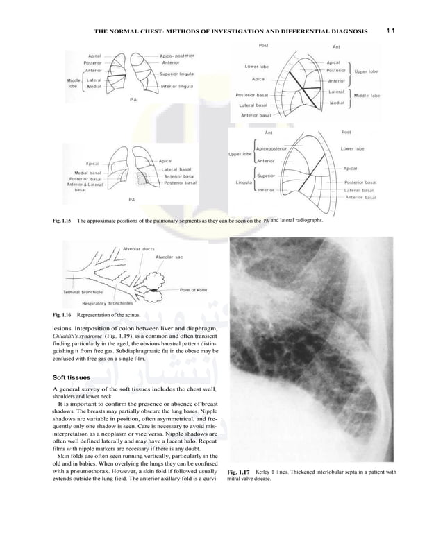 Textbook of Radiology and Imaging (Vol. 1) ( PDFDrive ).pdf