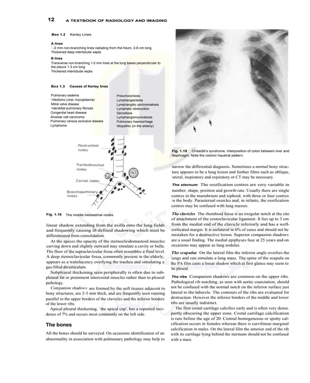 Textbook of Radiology and Imaging (Vol. 1) ( PDFDrive ).pdf