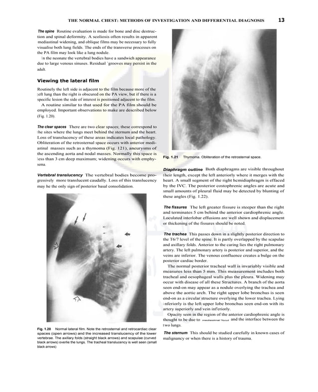 Textbook of Radiology and Imaging (Vol. 1) ( PDFDrive ).pdf