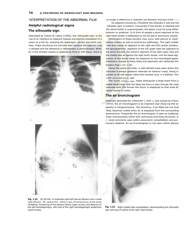 Textbook of Radiology and Imaging (Vol. 1) ( PDFDrive ).pdf