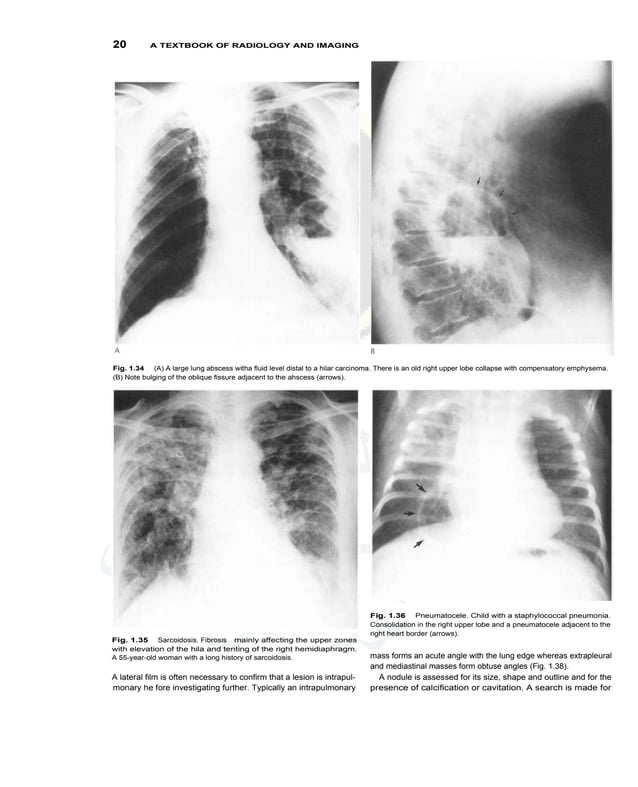 Textbook of Radiology and Imaging (Vol. 1) ( PDFDrive ).pdf