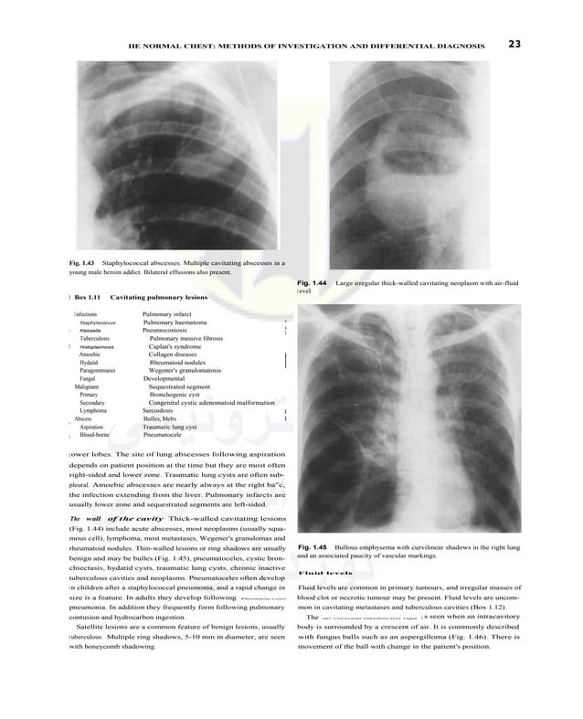 Textbook of Radiology and Imaging (Vol. 1) ( PDFDrive ).pdf